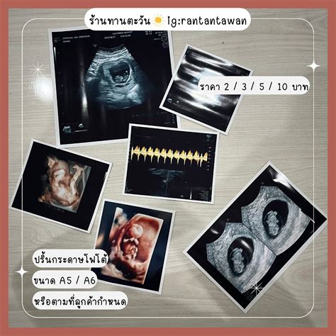 ♥️ปริ้นกระดาษโฟโต้♥️ 🌻รับปริ้นงาน ร้านทานตะวัน ปริ้นงาน