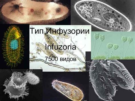 Тип Инфузории Infuzoria 7500 видов Infuzoria Отличительные