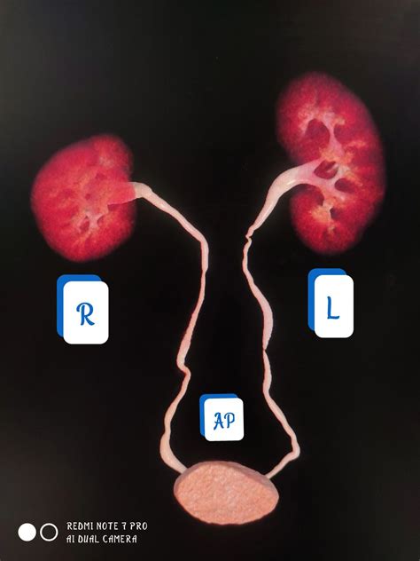 Md Emran Hossain On Linkedin Ctscan Cttechnologist Radiology