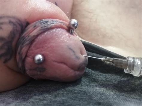 Saline Infusion Scrotum And Titti 3 L 72 Pics Xhamster