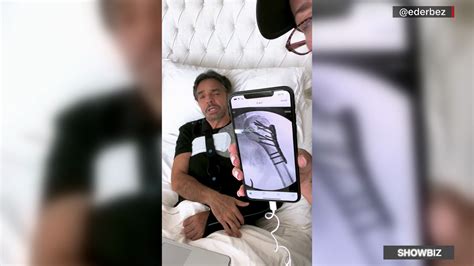 Eugenio Derbez Habla En Instagram De Su Accidente La Lesión Era Tan