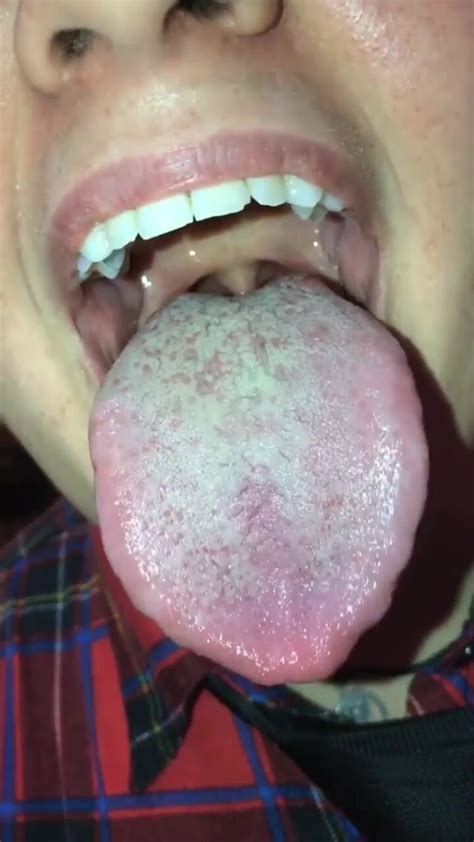 Big Tongue ThisVid Com