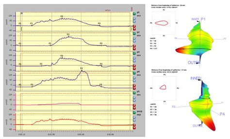 Three Dimensional Urethral Profilometry—a Global Urethral Pressure