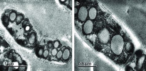 Electron Microscopy Of The Polyhydroxyalkanoates Granules Accumulated Download Scientific