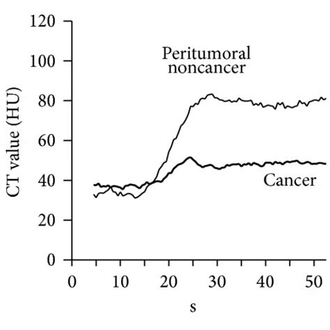 Analysis Of Pancreatic Perfusion Image We Analyzed The Ct Image