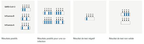 Test Covid Et Grippe Cest Quoi Prix Où En Pharmacie