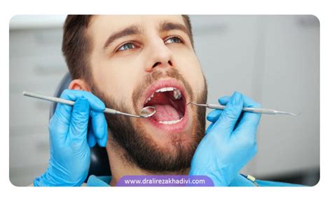 علت تلخی دهان چیست؟ 20 علت تلخی دهان و درمان آن دکتر خدیوی