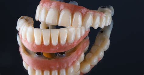 Adding A 3d Print Lab The Path To More Independence At Your Practice
