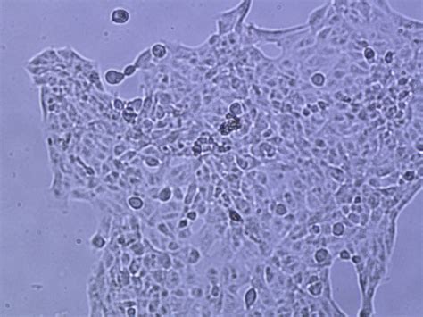 Has Anyone Performed Colony Formation Assays For Achn Cell Lines