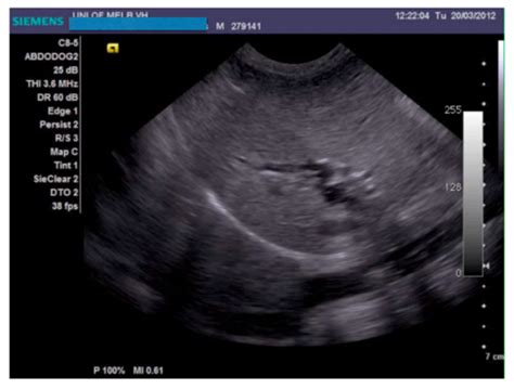 Imaging Principles Of Ultrasound Flashcards Quizlet
