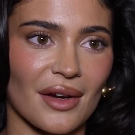 Can Someone Tell Me What This Top Lip Deformity Is Their Top Lip