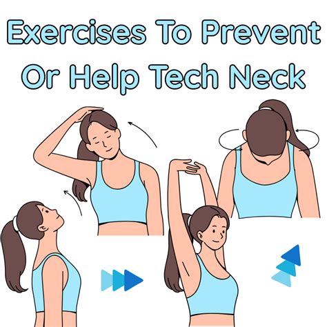 20 Effective Tech Neck Exercises Free Printable Checklist My