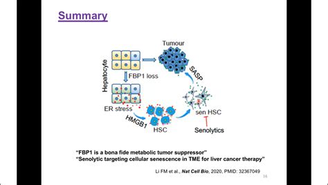 Fbp1 Loss Disrupts Liver Metabolism And Promotes Tumorigenesis Through