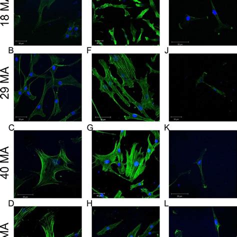Cytoskeleton Arrangement Was Altered By Substrate Stiffness Download Scientific Diagram