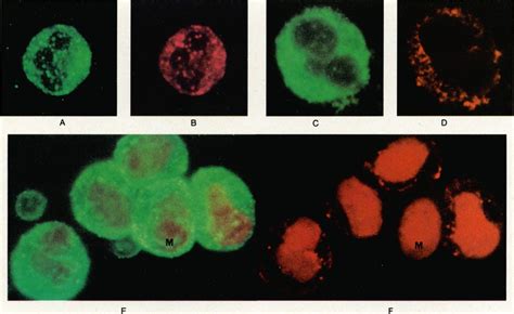 Atypical Lymphocytes With Azurophilic Granules