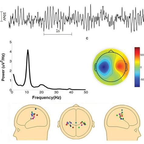 Brain Regions Whose Bold Signals Are Positively Correlated With Eeg Mu
