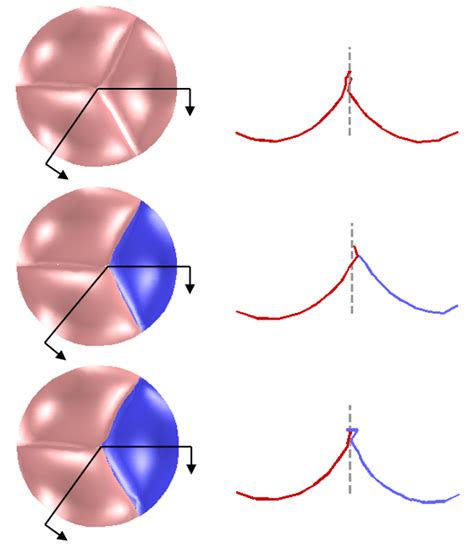 Hbl Research Heart Valve Comp Modeling