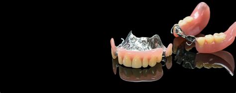 Valplast Dentures Solihull Missing Teeth Dorridge