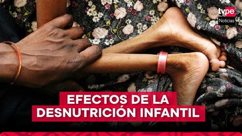 Desnutrición Infantil Cuáles Son Las Causas Y Consecuencias De Esta