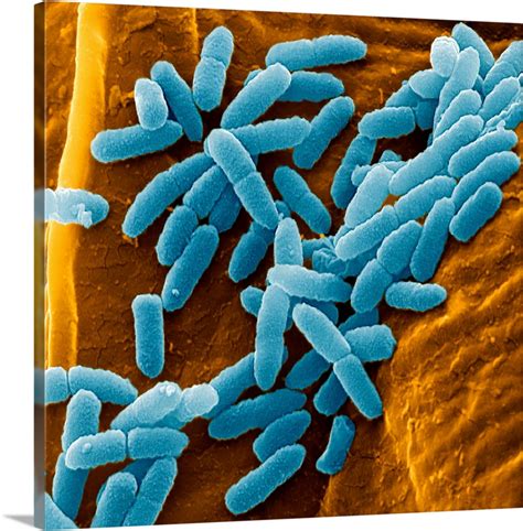 Pseudomonas Aeruginosa Bacteria Sem Wall Art Canvas Prints Framed
