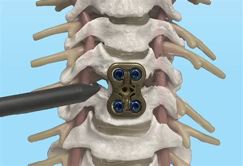 Procedures Dr Neill Wright