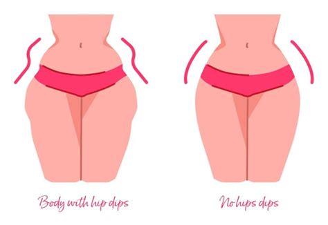 The Truth About Hip Dips — And Why You Shouldnt Worry About Them