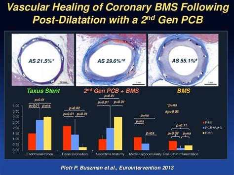 Novel Paclitaxel Coated Balloon Dr Piotr Buszman