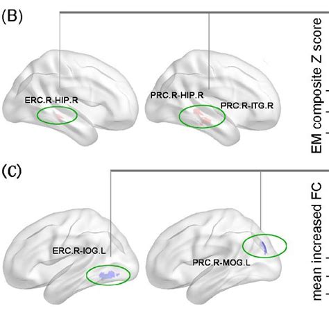 Schematic Drawing Of Medial Temporal Lobe A Plus The Components Of Download Scientific