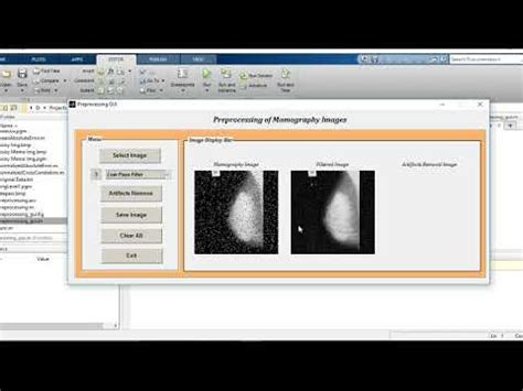 MATLAB Projects Of Digital Image Processing Audio Processing Video