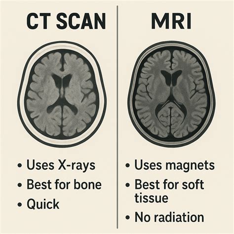 Radiographicgyan Difference Between Ct Scan And Mri