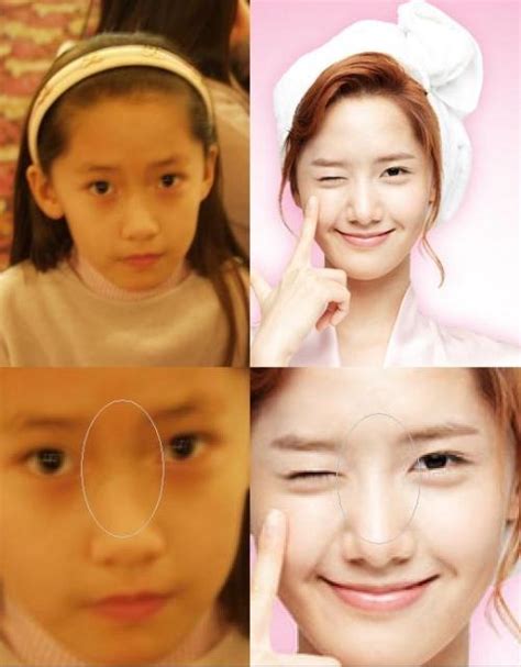 Yoona Plastic Surgery Belly Button