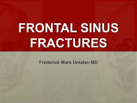 Frontal Sinus Fracture Ppt