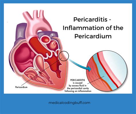 2021 Cpt Appendix A Guide Notes Examples And Bonus Anatomy For Cpc Exam