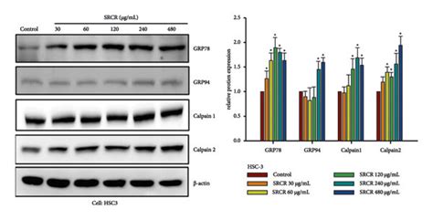 Srcr Induced Ca²⁺ Release And Activation Of Er Stress In Human Oscc