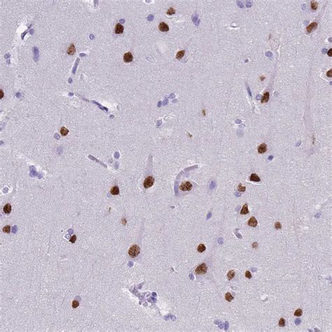 Mouse Monoclonal Anti Satb2 Antibody Buy For Research Highly