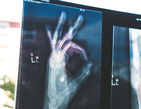 Stampa 3d Da Team Italiano Attuatori Per Muscoli Artificiali