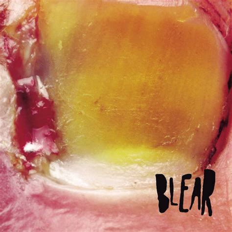 Blear - Blear: тексты и песни | Deezer