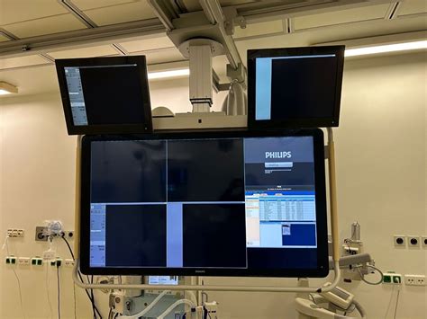 Used Philips Allura Fd2020 Angio Lab For Sale Dotmed Listing 4889534
