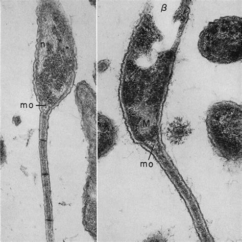 And 5 Thin Sections Of Caulobacter Crescentus Cb15 Figure 4 Gro~m In Download Scientific