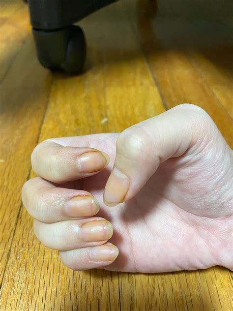 問題 指甲泛黃是發霉嗎？ 美甲板 Dcard