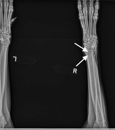 Image Gallery Primary And Metastatic Tumors Part 2 Clinicians Brief
