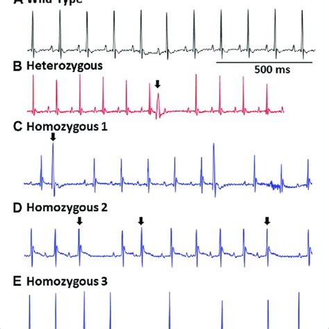 representative egcs in wild type and dmsxl mice standard ecg reading