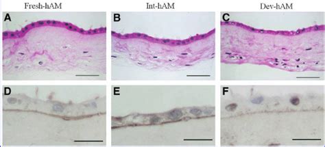 Hematoxilin And Eosin Hande And Collagen Iv Col Iv Staining Of Human