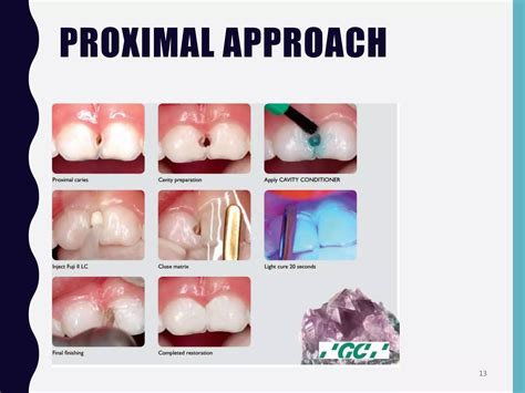Minimally Invasive Dentistry Pptx