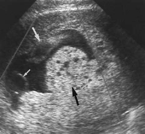 Fetal Environment Part 2 Flashcards Quizlet