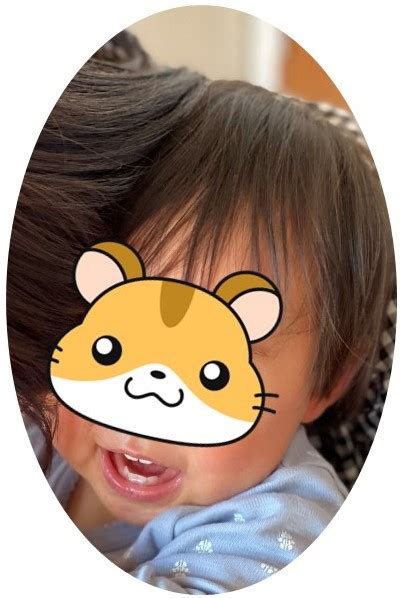 1歳児の受け口 田町の矯正歯科「田町東口矯正歯科」