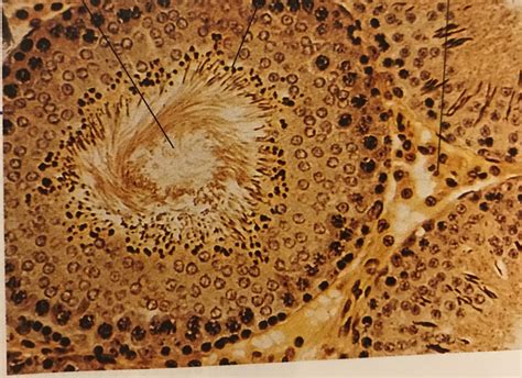 Cross Section Enlargement View Of The Seminiferous Tubules Shows