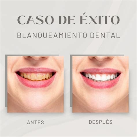Explorá Plantillas De Antes Y Después Personalizables Gratis Canva