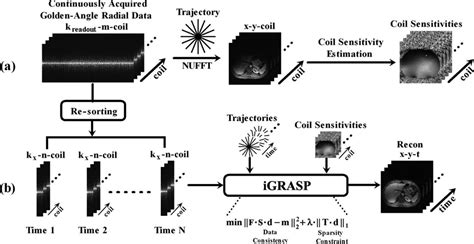 Golden Angle Radial Sparse Parallel Mri Combination Of Compressed Sensing Parallel Imaging