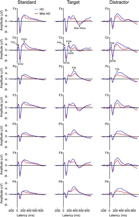 Grand Average Erps For Standard Target And Distractor Stimuli In Mild